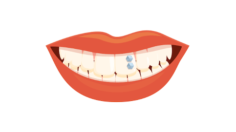 The Truth About Tooth Gems: Can They Cause Damage? | Contemporary ...
